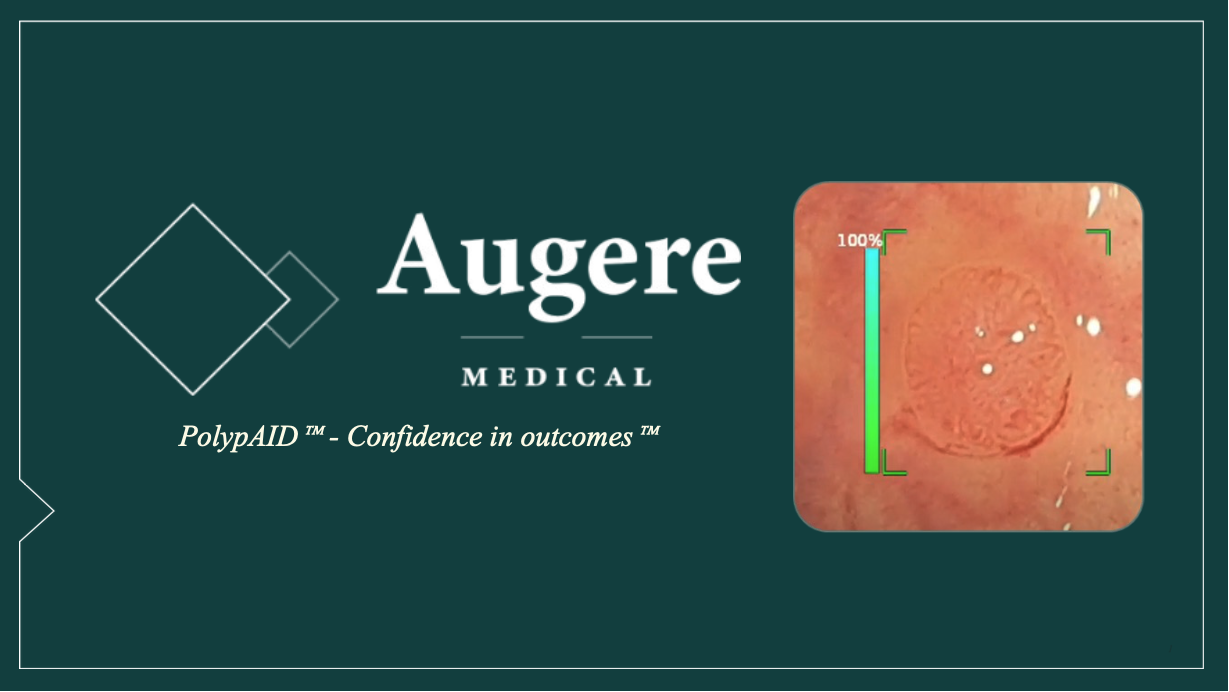 Dealflow - kapitalkilde for vekstselskaper, investeringsmuligheter for alle